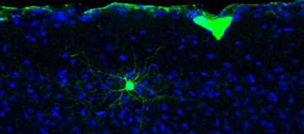 The brain: a tuneable 'hardware' |ERC